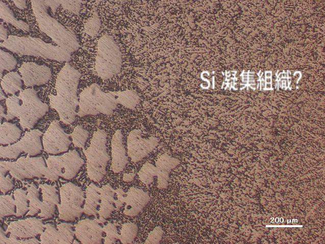 アルミ鋳物AC4Cの組織観察をしていると，この写真のようにSiが凝集したような領域が観察されることがあります．原因は何でしょうか？また，機械的 ...